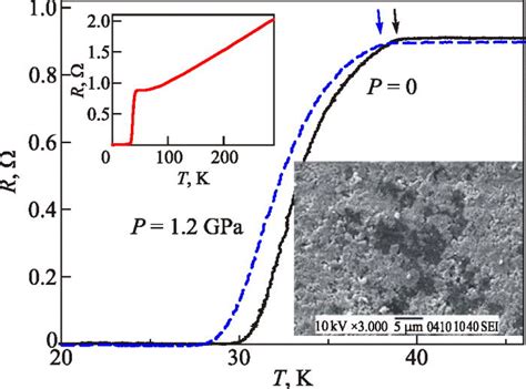 Resistive Normal To Superconductor Transition R Of The Granular Mgb2 Download Scientific