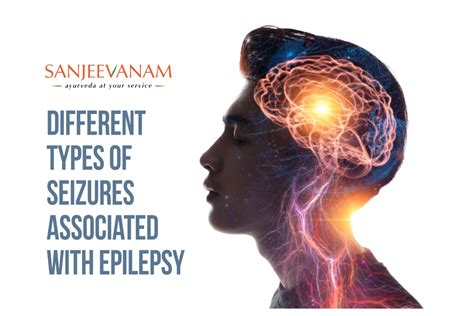 PPT Different Types Of Seizures Associated With Epilepsy PowerPoint Presentation ID 12239617