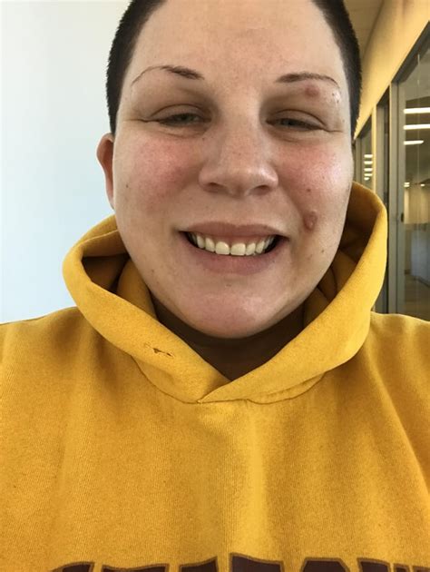 My Denture Adventure Rdentures
