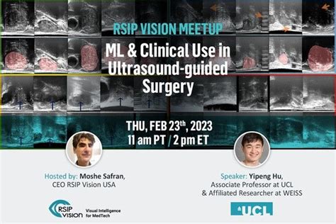 Rsip Vision On Linkedin Machinelearning Liver Urology Surgery Ultrasound