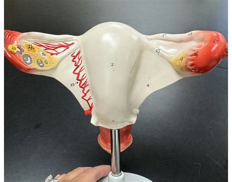 Uterus Posterior Quiz