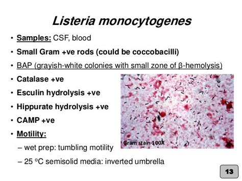 Listeria Spp