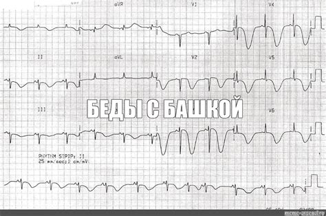 Meme БЕДЫ С БАШКОЙ All Templates Meme