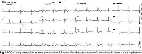 Figure 1 From Reversible Intraventricular Conduction Defect In Aconitine Poisoning Semantic