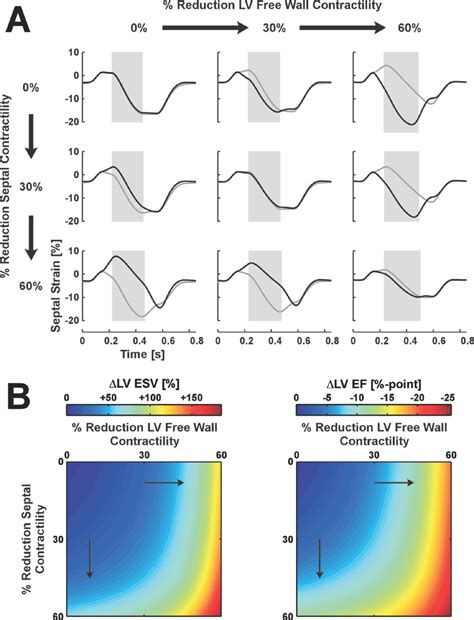 Figure S2 Effect Of Decreased Myocardial Contractility On The Septal Download Scientific