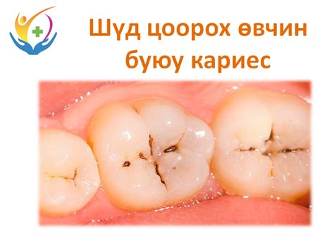 Хелико бактери Facebook