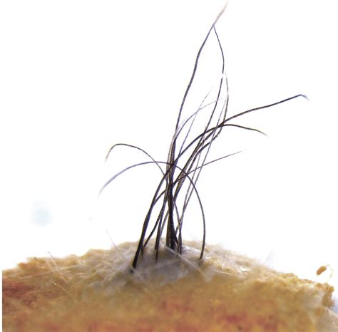 Hairy Human Skin Generated From Stem Cells National Institutes Of