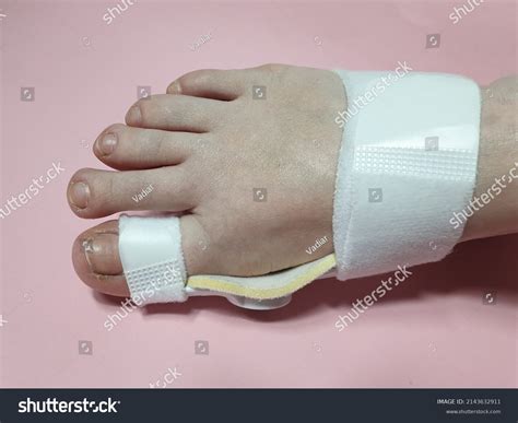 정형외과 결함 교정 스톡 사진 2143632911 Shutterstock