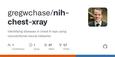 Nih Chest Xray Chest Xray8 Pdf At Master Gregwchase Nih Chest Xray