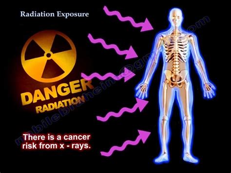 X Ray Radiation Logo