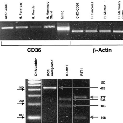 Rt Pcr And Restriction Enzyme Digestion Of The Amplified Product Using