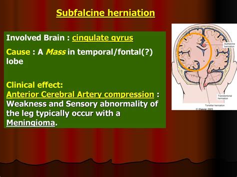 Cns Dr Amitabha Basu Md Ppt Download