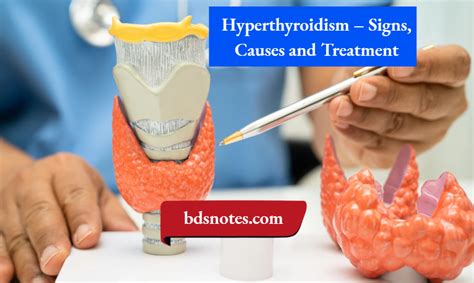 Hyperthyroidism Signs Causes And Treatment Bds Notes