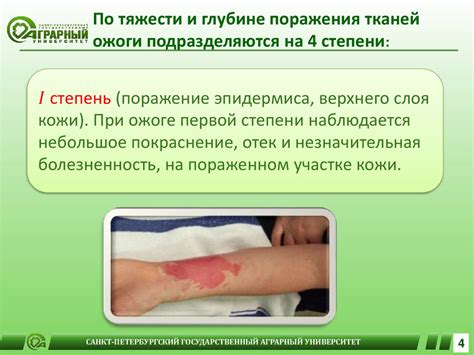 Первая помощь при химическом ожоге презентация онлайн