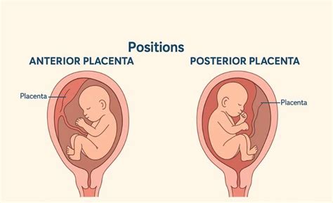 Difference Between Anterior And Posterior Placenta A Detailed Guide By