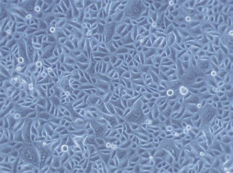 Normal Human Epidermal Keratinocytes Nhek Promocell Cells
