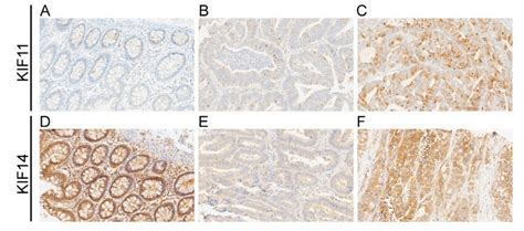 Representative Photographs Showing Immunohistochemical Expression Of Download Scientific