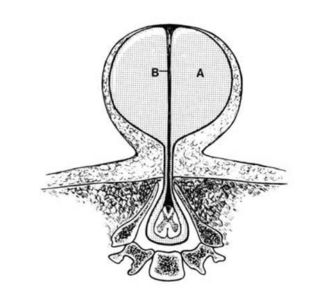 Case Of The Week 531