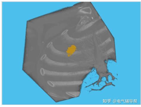 【3 d深度学习：肺肿瘤分割】创建和训练 v net 神经网络，并从 3d 医学图像中对肺肿瘤进行语义分割研究（matlab代码实现） 知乎