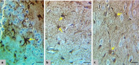 Immunohistochemistry Section In The Brain For Brown Nucleus S100