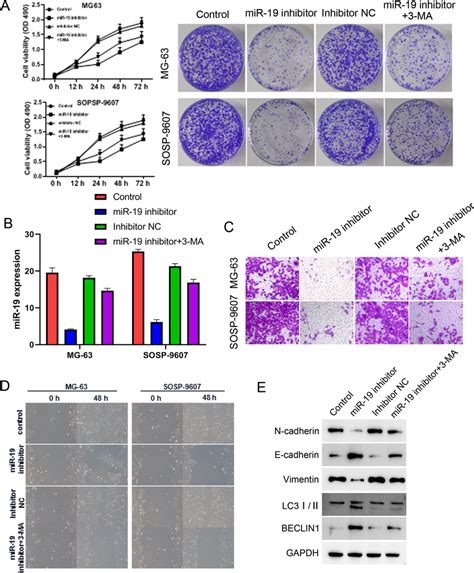 Mir 19 Inhibitor Suppresses Cell Proliferation Invasion Migration