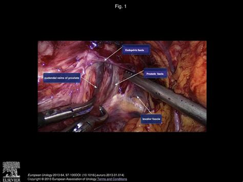 Volume 64 Issue 1 Pages July 2013 Ppt Download