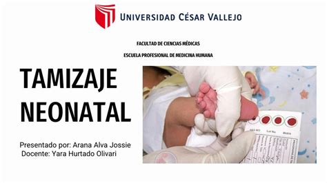 Tamízaje Neonatal Jossie Arana Udocz