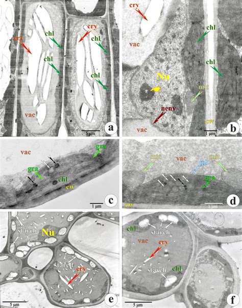 Palisade Cell Diagram