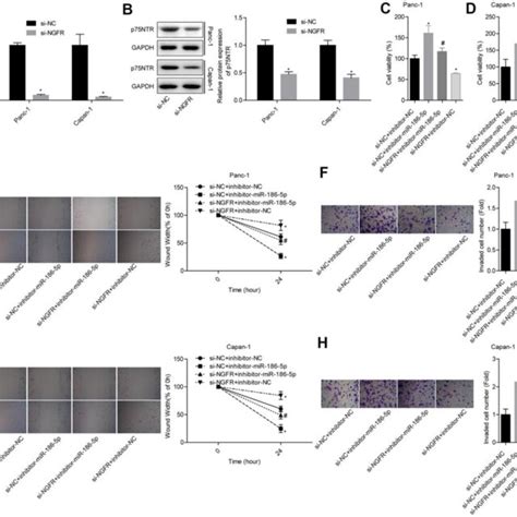Mir 186 5p Inhibits The Migration And Invasion Of Pancreatic Cancer By
