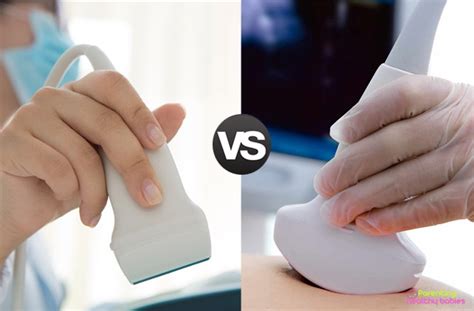 Difference Between Ultrasound And Sonogram Ukmilo