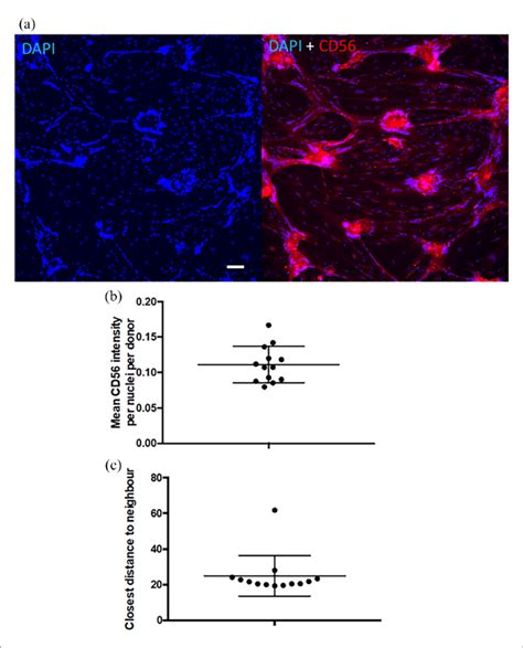 Cd56 Intracellular Expression A Image Taken With Inverted Microscope Download Scientific