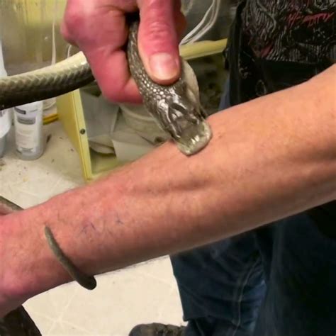 Deadliest Snake Bite In The World Venomous Snake Bites On The Rise In