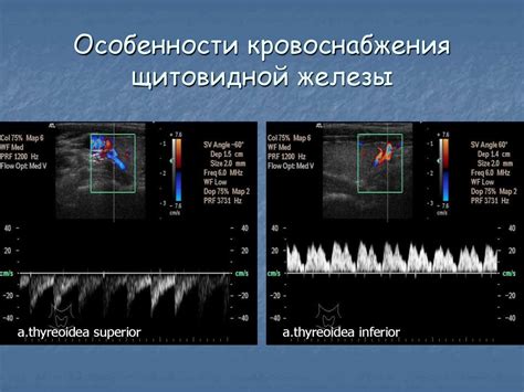 Ультразвуковая диагностика заболеваний органов шеи и щитовидной железы