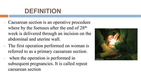 Lower Segment Cesarean Section Powe Point Presention Pptx