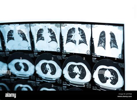 A Female Doctor Examines An Mri Scan Of The Internal Organs Abdomen