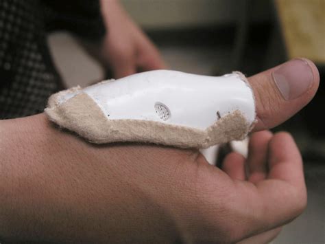 Athletic Trainer Tips Taping And Bracing Uoa University Orthopaedic Associates Athletic Trainer Tips Taping And Bracing Uoa University Orthopaedic Associates