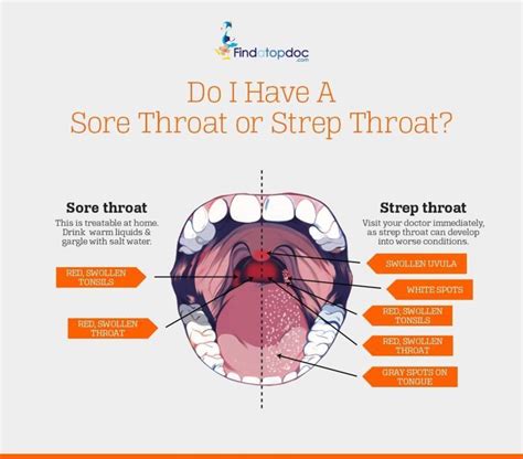 Is It A Sore Throat Or Strep Throat Infographic