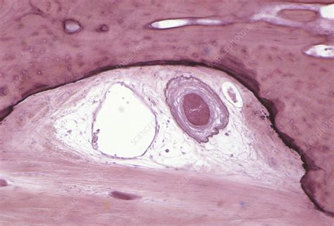 Cross Section Of A Vein And Artery LM Stock Image C005 2724 Science Photo Library