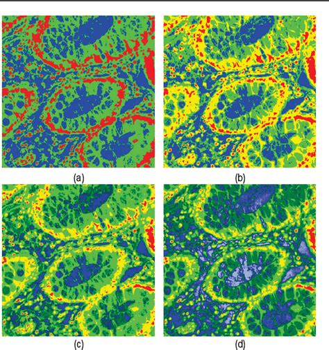 figure 4 from a new augmented k means algorithm for seed segmentation
