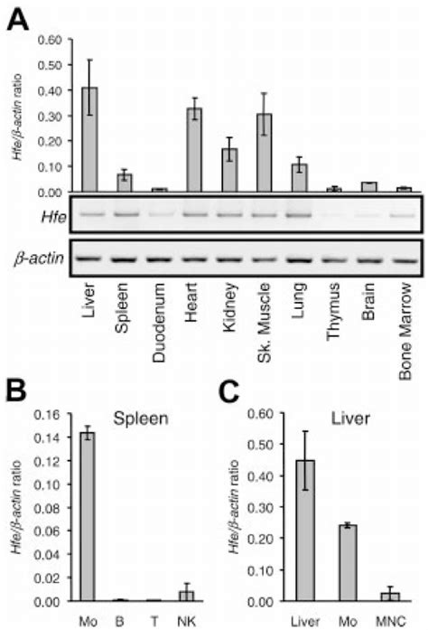 Analysis Of Hfe Gene Expression Download Scientific Diagram