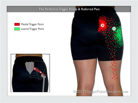 Piriformis Trigger Points Double Trouble TriggerPointTherapist