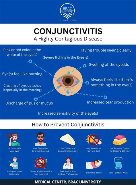 Awareness On Conjunctivitis Brac University