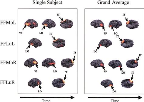 Current Source Density Csd Using Minimum Norm Sources Are Presented