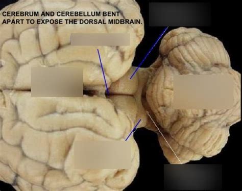 Superior View Of Sheep Brain Diagram Quizlet