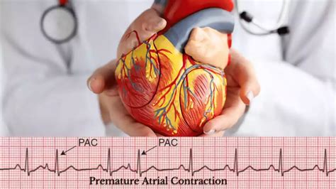 Difference Between PAC And Sinus Arrhythmia Productive Difference