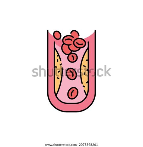 Atheroma Color Line Icon Human Diseases Stock Vector Royalty Free