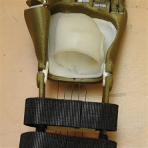 B Image Of 3d Printed Hand Prosthesis Permission Granted From Fig 5