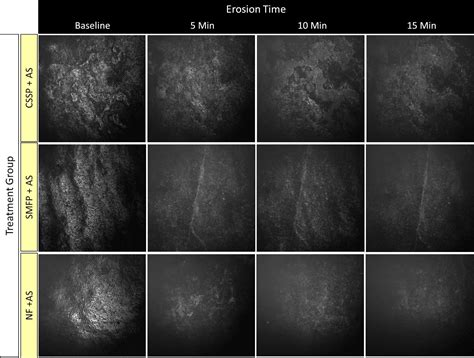 Figure 4 From Superimposition Of Sequential Scans To Measure Erosion On