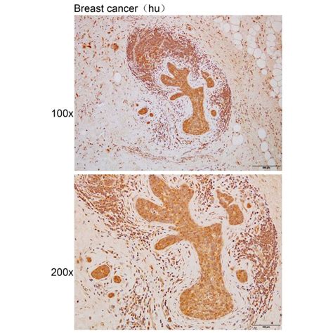 Solarbio K111727p Anti Nudt1 Polyclonal Antibody 试剂仪器耗材