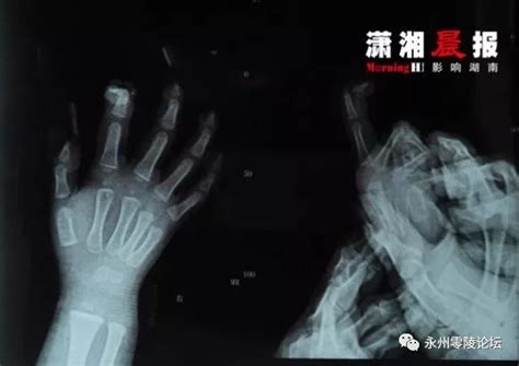 别以为“兔子急了会咬人”只是说说，湖南就发生兔子咬人真事了